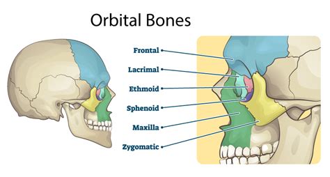 Orbital Bone Fracture Open Reduction Internal Fixation For Noe Type