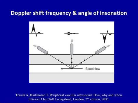 Principles Of Doppler Ultrasound
