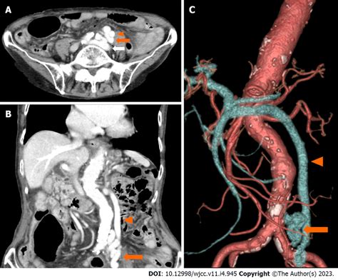 Abdominal Computed Tomography Scan With Contrast Enhancement A C Download Scientific Diagram