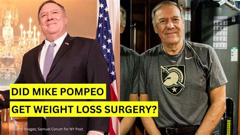 Did Mike Pompeo Get Weight Loss Surgery Obesity Reporter