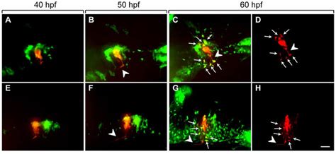 Fate Mapping Reveals That Abducens Motor Neurons And Some Opcs Arise