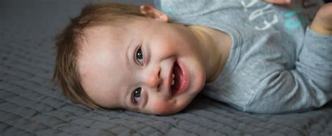 Understanding Chromosomal Abnormalities And Their Impact On Health