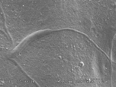 50 Million Year Old Worm Sperm Found In Antarctica National Geographic