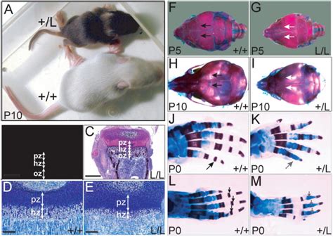 Dusp6 Mkp3 Is A Negative Feedback Regulator Of Fgf Stimulated Erk Signaling During Mouse