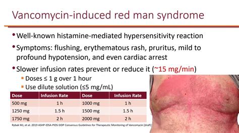 Cardiophilia 𝗩𝗮𝗻𝗰𝗼𝗺𝘆𝗰𝗶𝗻 𝗳𝗹𝘂𝘀𝗵𝗶𝗻𝗴 𝘀𝘆𝗻𝗱𝗿𝗼𝗺𝗲 𝗩𝗙𝗦 𝗮𝗹𝘀𝗼 𝗸𝗻𝗼𝘄𝗻 𝗮𝘀