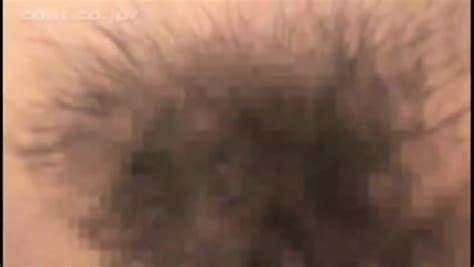 Japanese Doctor Visit Eporner