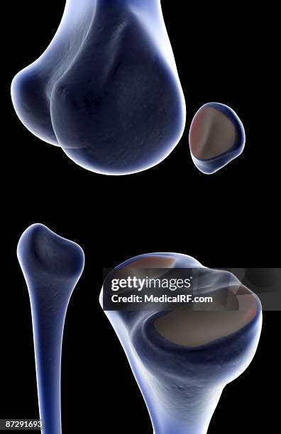 69 Medial Epicondyle High Res Illustrations Getty Images