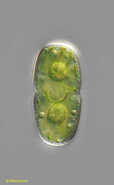 Xanthidium Antilopaeum Real Micro Life