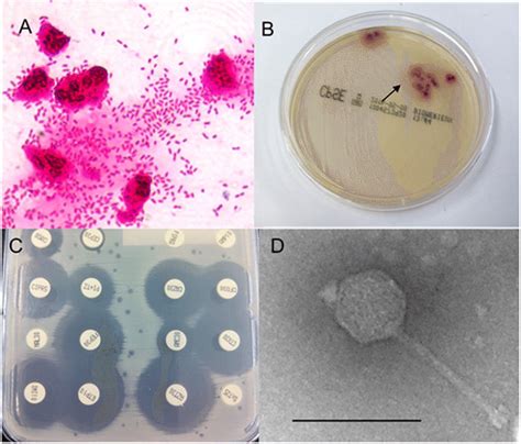 Interference Of Phages In Bacterial Isolation A Chromid™ Cps® Elite Download Scientific