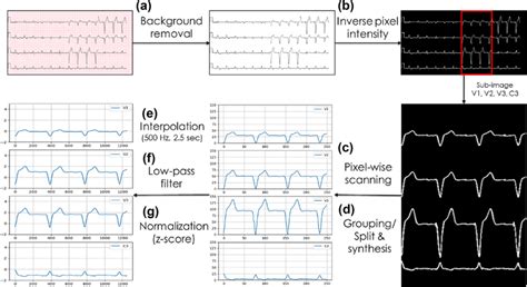 The Ecg Data Input Format A The Red Grid Background Of The 12 Lead Ecg