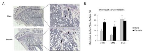 Intrinsic Sex Linked Variations In Osteogenic And Adipogenic