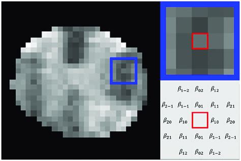 Markov Random Field Model Shown Are An Example T2 Weighted Mr Image