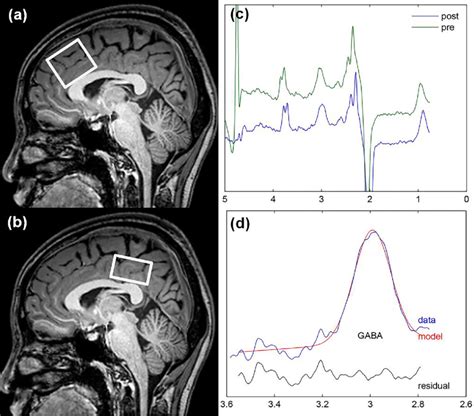 Mescher Garwood Point Resolved Spectroscopy Mega Press Voxel Position Download Scientific