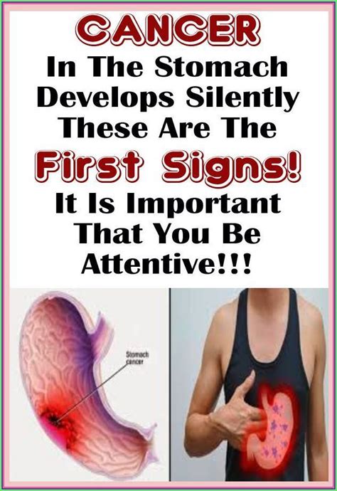 Stomach Cancer A Silent Killer Here Are The Signs Symptoms Artofit
