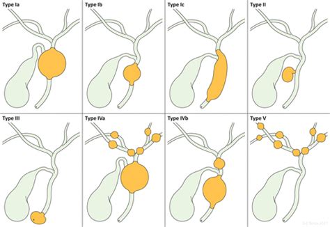 Imaging Of Biliary Tree Abnormalities Radiographics
