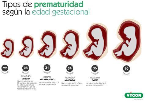 Causas Y Complicaciones De La Prematuridad ¿cómo Manejarlas