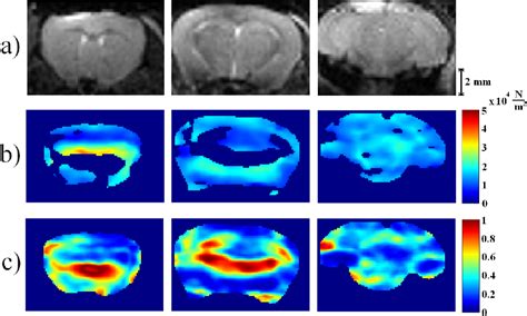 Figure 11 From Measurement Of The Dynamic Shear Modulus Of Mouse Brain