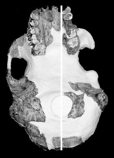 New Reconstruction Of Stw 53 In Inferior Aspect