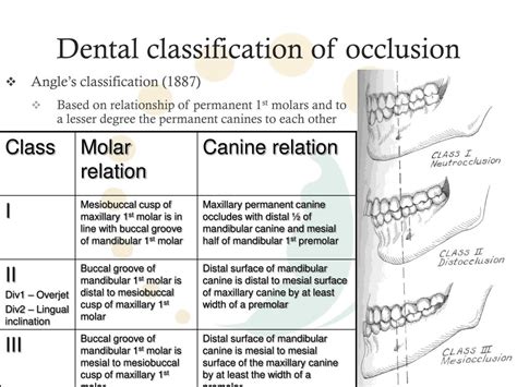 Angles Classification Dental Occlusion At Martha Chouinard Blog