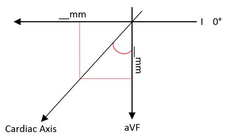 Ecg Axis Calculator