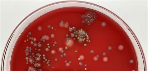Pervasive Horizontal Gene Transfer In Coagulase Negative Staphylococcus Microbiology Community