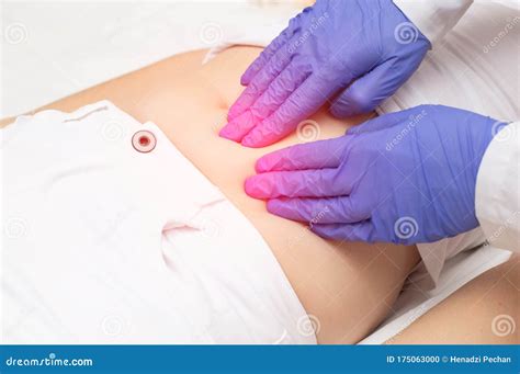 Ovarian Cyst Light Micrograph Photo Under Microscope Cartoondealer