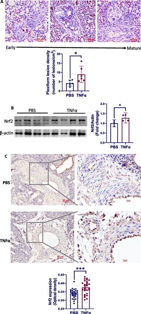 Intratracheal Tnfα Installation Enhances The Formation Of Plexiform