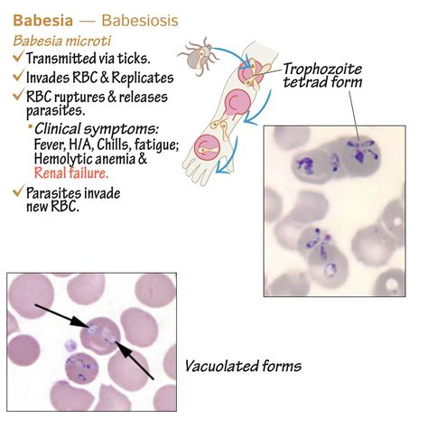 Immunologymicrobiology Glossary Protozoa Babesia And Babesiosis