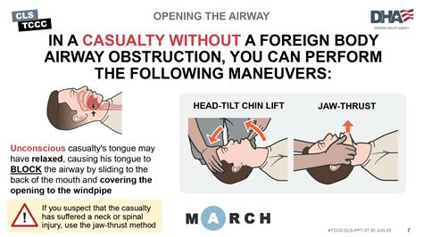 Airway Management In Tfc