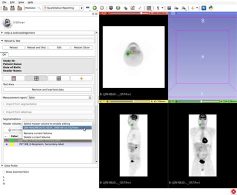 Master Volume Selector Is Editable After Loading From Sr Issue Qiicr