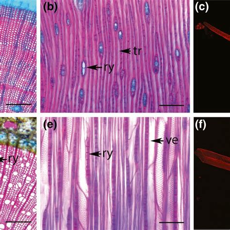 Transverse Stem Sections Of A Gymnosperm Species Pinus Radiata A And Download Scientific