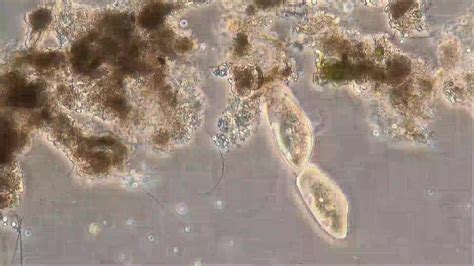 Microbe Object Detection Dataset By Nycu