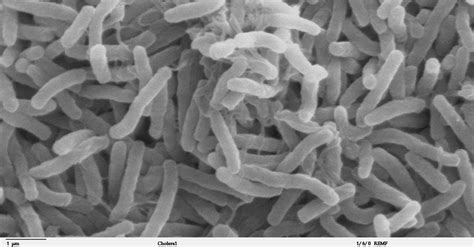 Germ Theory World History Encyclopedia