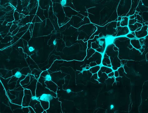 Getting Started With Super Resolution Imaging Of Neuronal Cultures