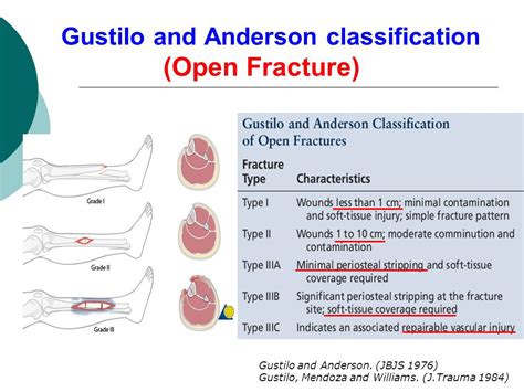 Dickyrickys Remedial Repository