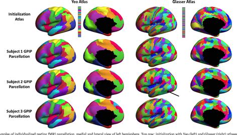 Figure 2 From Individual Parcellation Of Resting Fmri With A Group