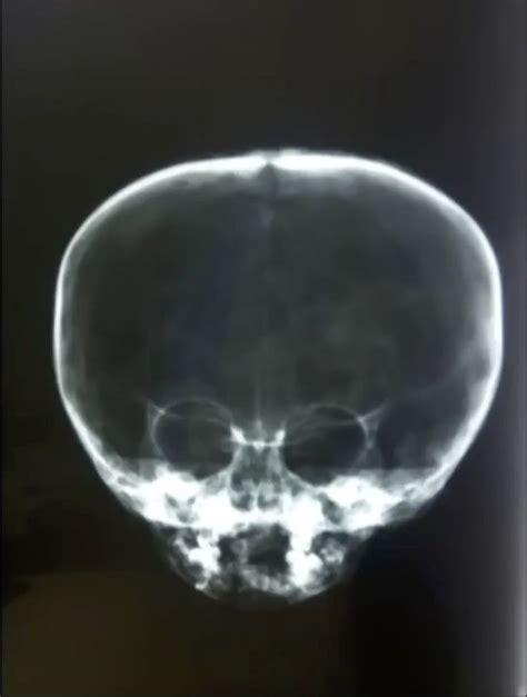 Media Posts By Nazca Mummies Nazcamummies X Nazca Media Post