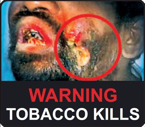 Warning Tobacco Kills Image 3