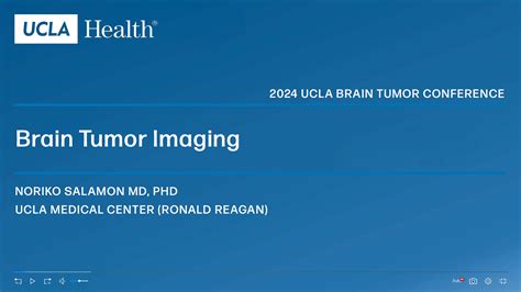 2024 Ucla Brain Tumor Conference May 10th And 11th