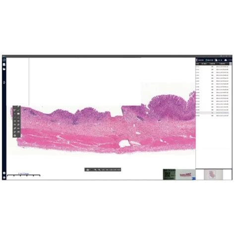 Купить автоматический сканер гистопрепаратов Adf Ssc в Москве «dmicro