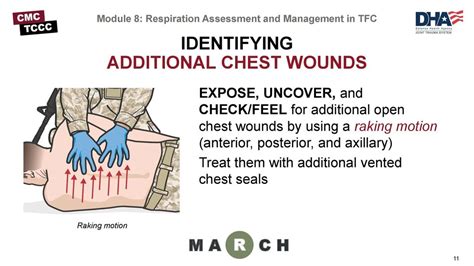Respiration Assessment And Management In Tfc