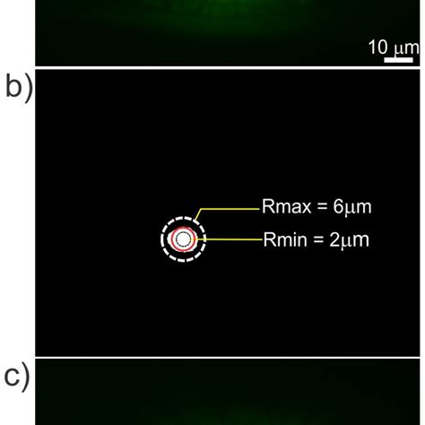 The Circular Object Detection Methodology To Detect A Cell Body In The Download Scientific