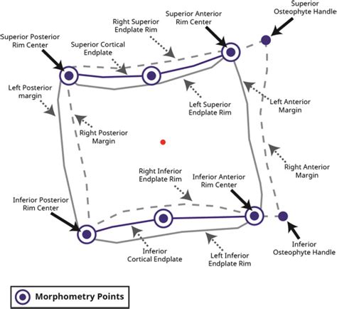 Quantitative Morphometric Vertebral Fracture Assessment Method