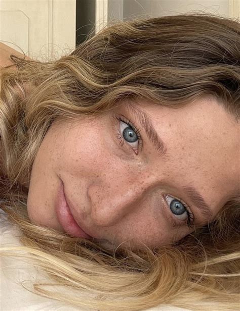 My Ex Didnt Really Use To Like My Freckles What Do You Think R
