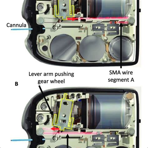 Figure3 Omnipod DASH Personal Diabetes Manager PDM Pod And Download Scientific Diagram