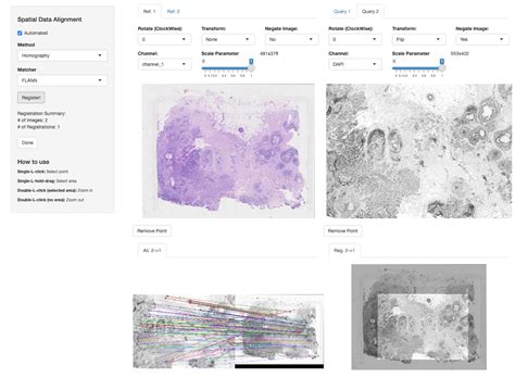 31 Spatial Registration Orchestrating Spatial Transcriptomics Analysis With Bioconductor