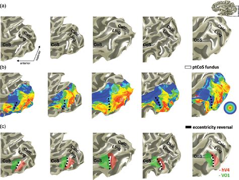 Posterior Transverse Collateral Sulcus Semantic Scholar
