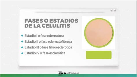Celulitis Tipos Y Como Eliminarla Ppt