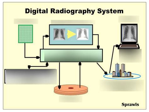 Digital Radiography Diagram Quizlet