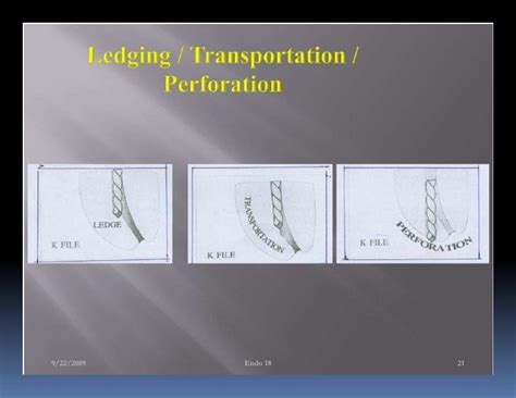 Endo Note 18 Ledge Formation